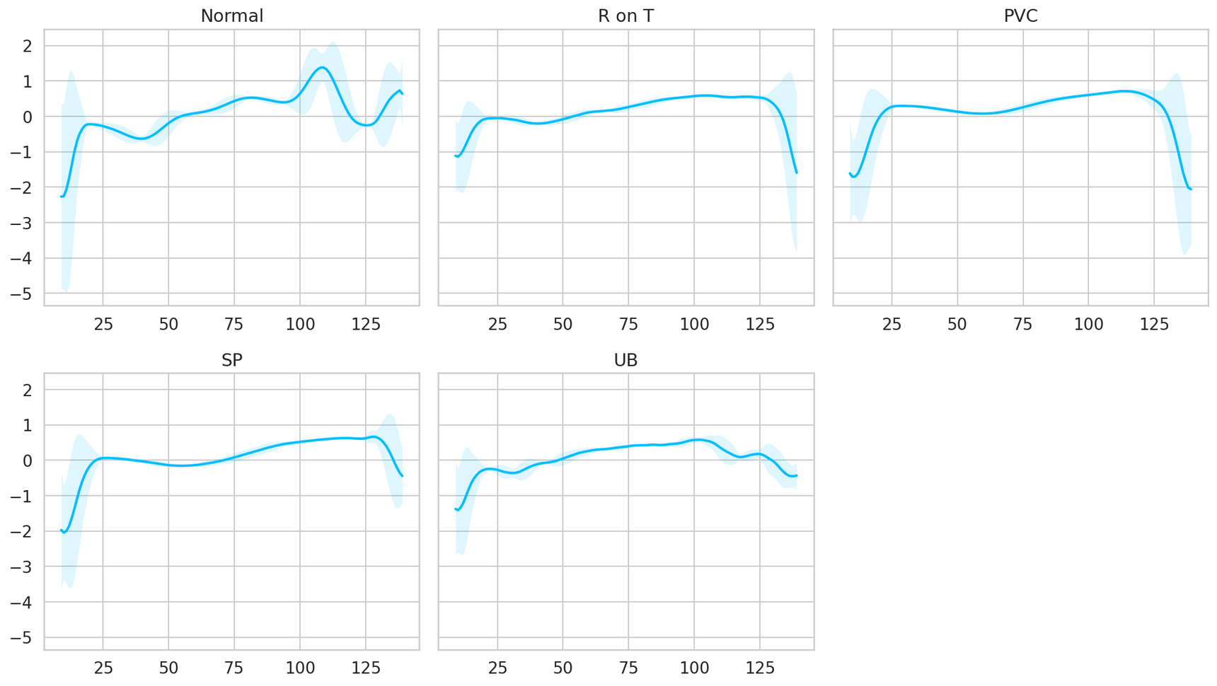 Time Series Anomaly Detection Using Lstm Autoencoders With Pytorch In Python Curiousily 8107