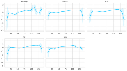 Time Series Anomaly Detection using LSTM Autoencoders with PyTorch in ...